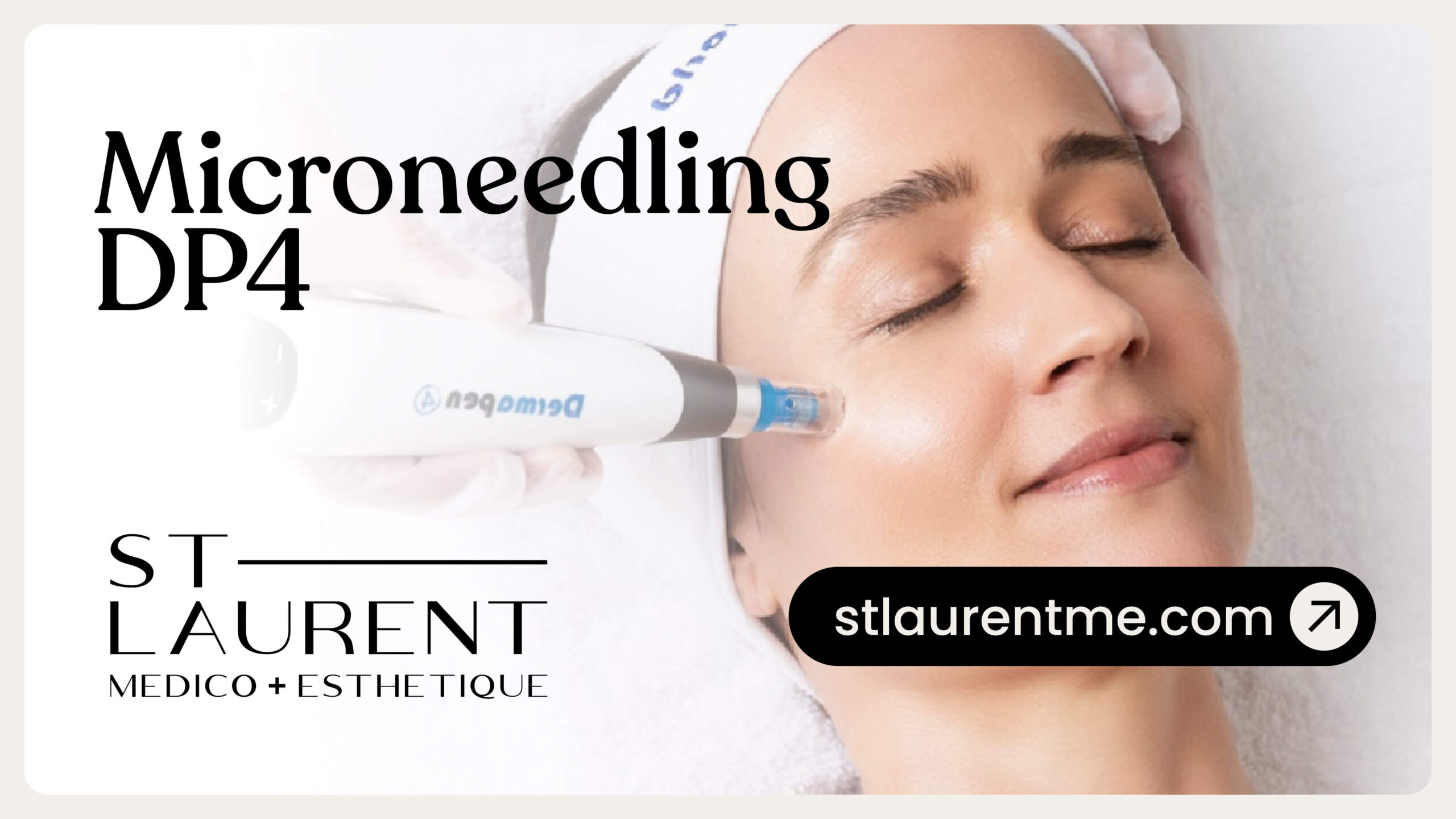 Microneedling DP4 | St-Laurent Médico-Esthétique