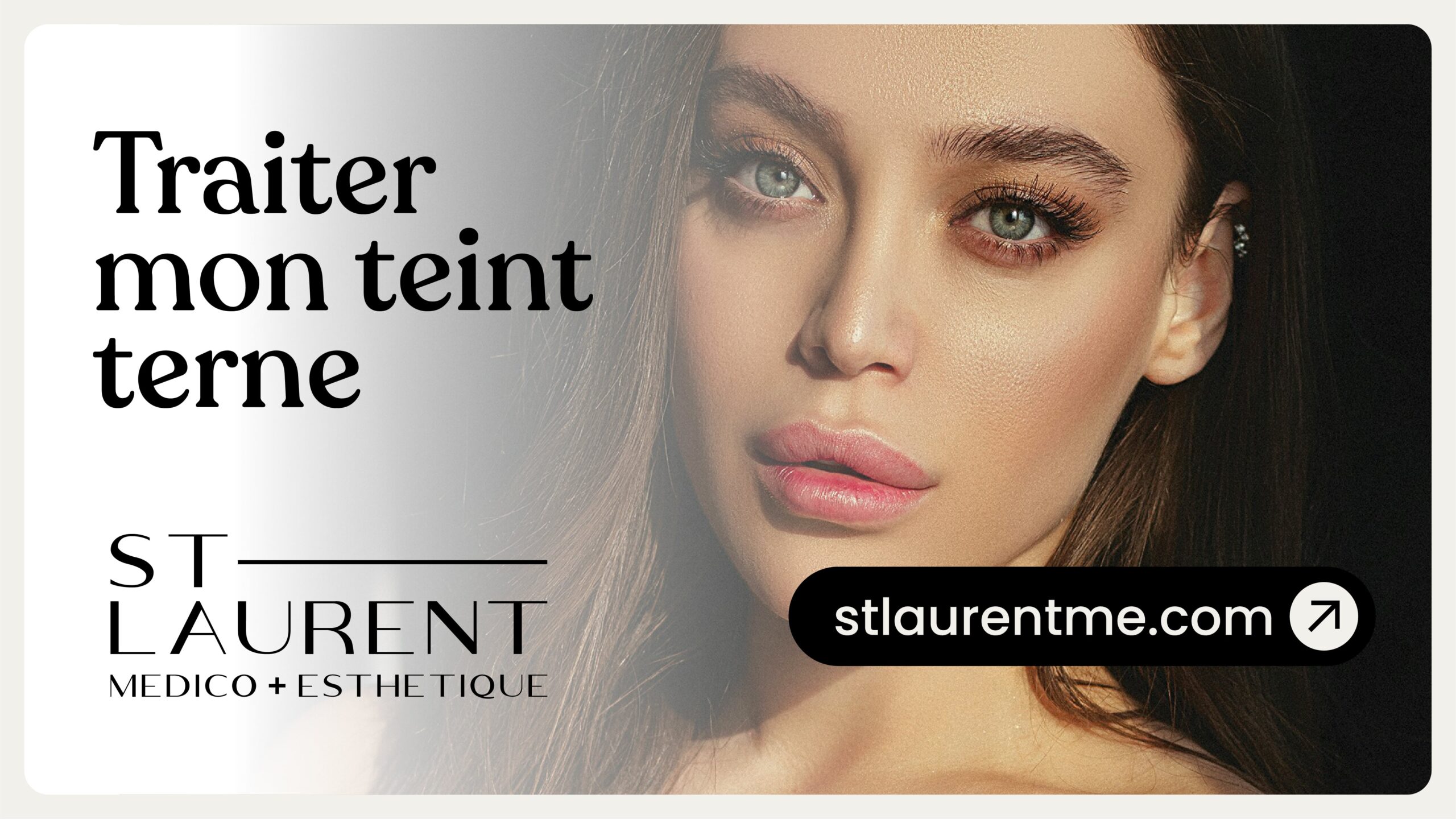 Teint terne | Coup d'éclat | St-Laurent Médico-Esthétique