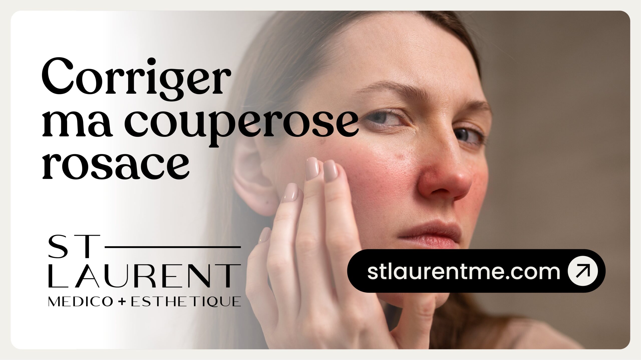 Corriger ma couperose, rosace | St-Laurent Médico-Esthétique